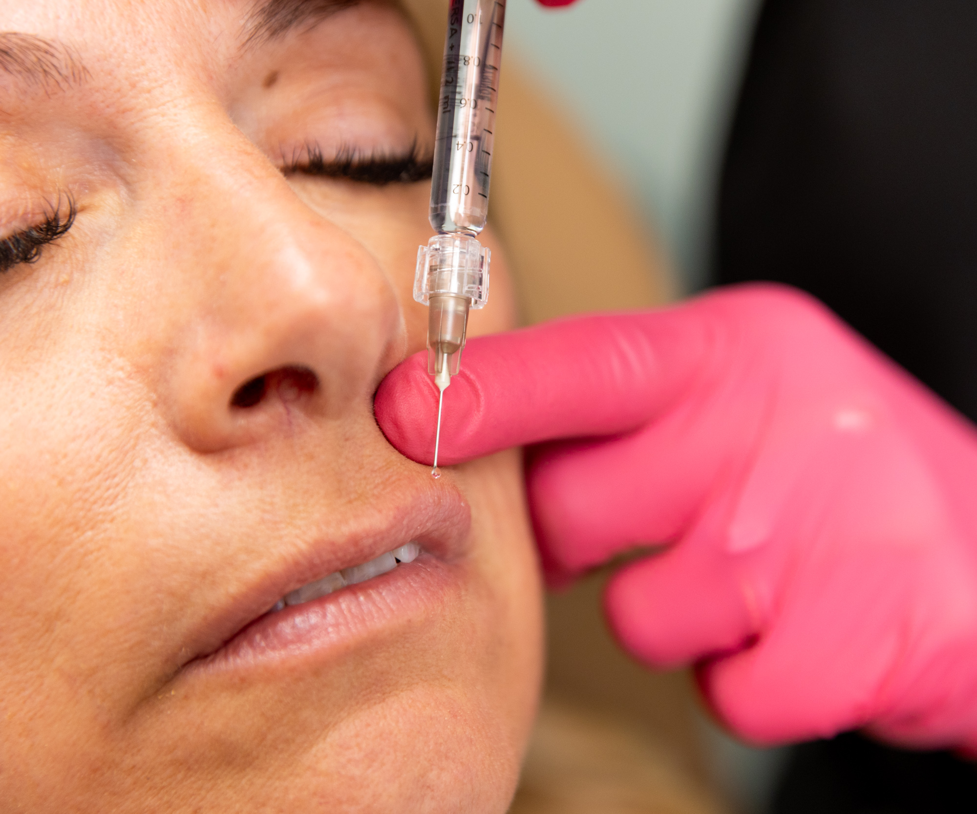 Aesthetics - Norma Roche MD